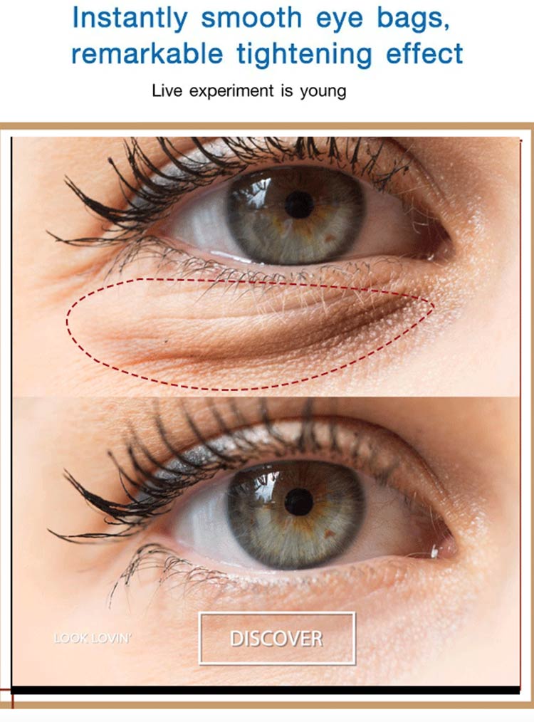 Senior Citizen Discount - Buy 1 Take 1-Astaxanthin Caviar Eye Cream ...