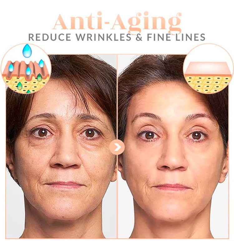 Anniversary Carnival - Buy now and save ₱300-Hot Sale In Korea-Bounce ...